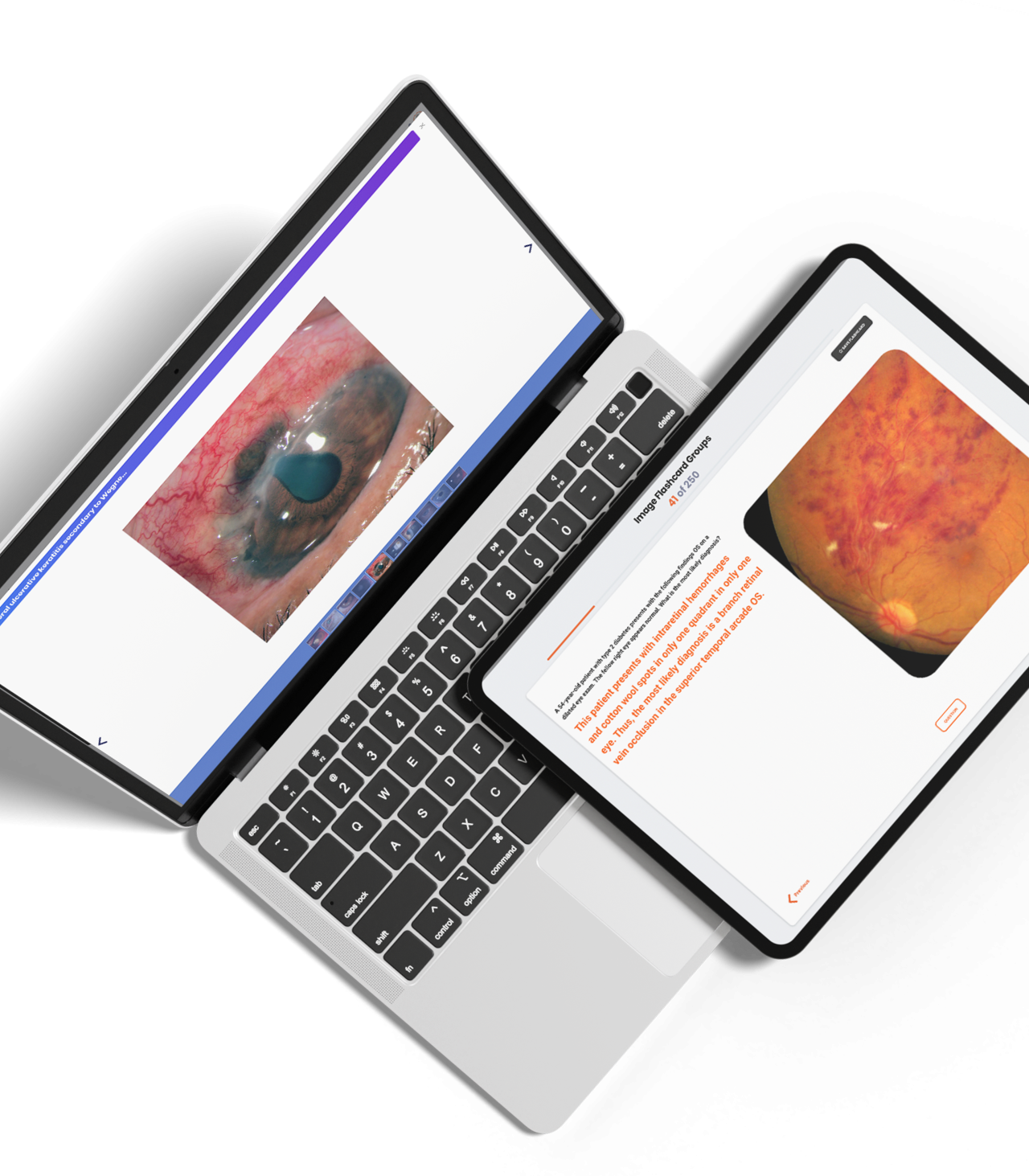 Homepage - KMK Optometry™ Boards Review